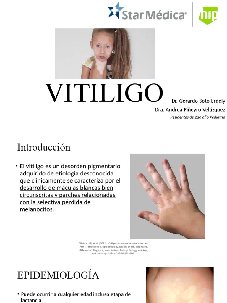 Clase Vitiligo - HIP | PDF | Especialidades Medicas | Medicina CLINICA