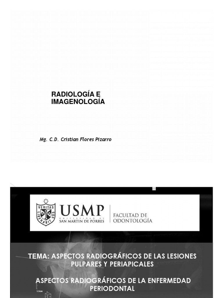USMP Aspectos Radiográficos de Las Lesiones Pulpares y Periapicales ...