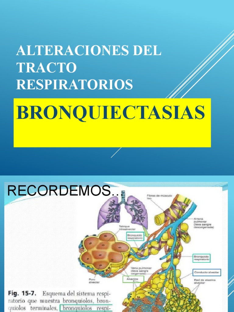 Bronquiectasia Pdf Tos Ciencias De La Salud