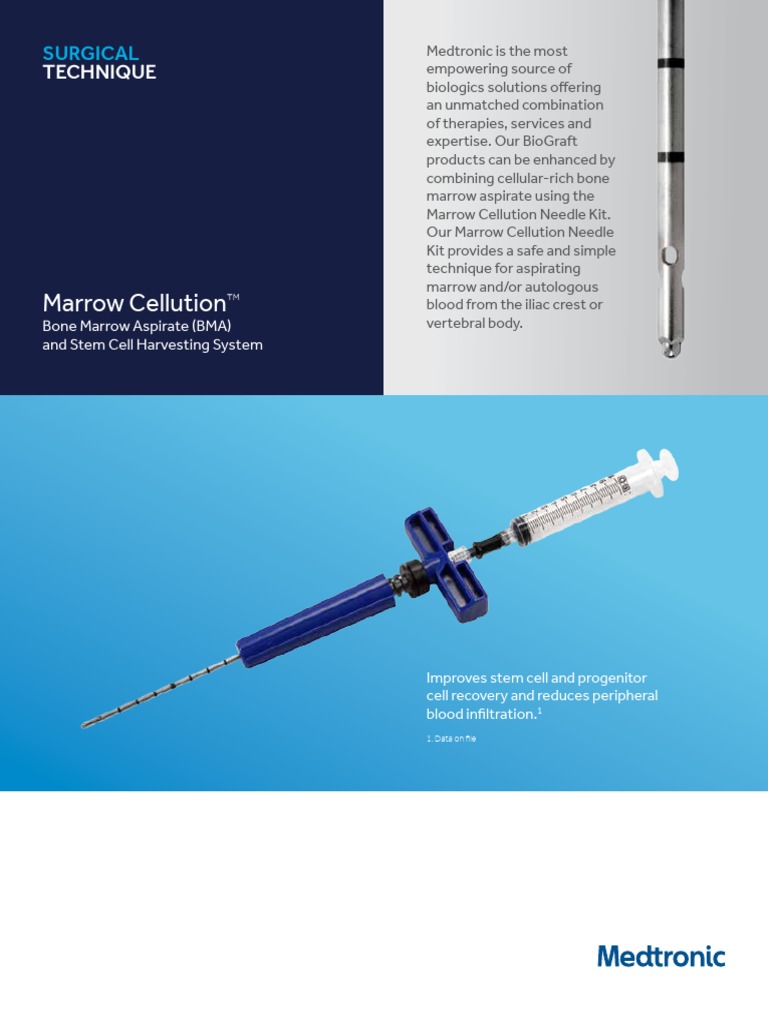 Bone Grafting HCP Spine Marrow Cellution Bma Surgical Technique Guide ...