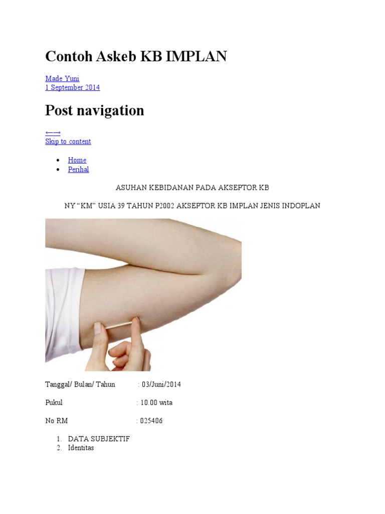 Asuhan Kebidanan KB Implan | PDF | Kesehatan Holistik