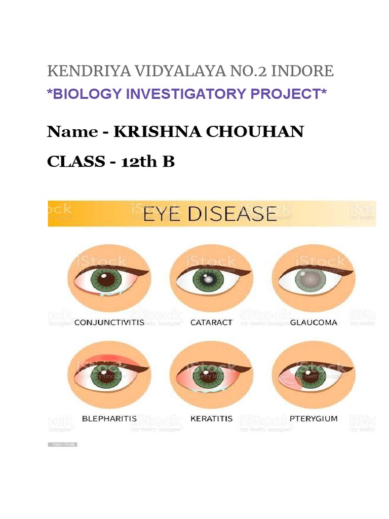 Eye Diseases 2 | PDF | Glaucoma | Cataract
