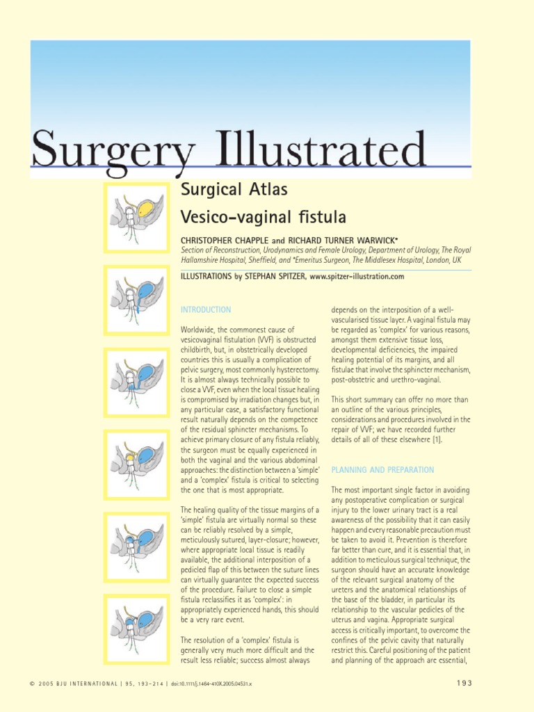 Surgical Atlas Part of The Book | PDF | Catheter | Surgery