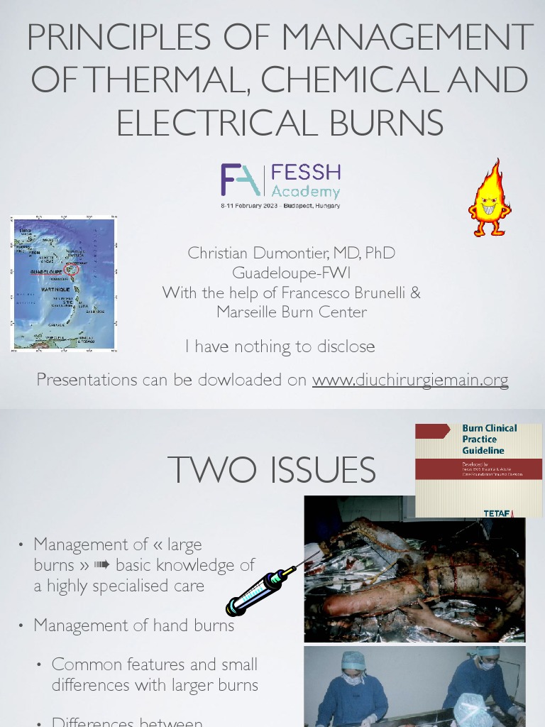 3-4 Management Hand Burns | PDF | Burn | Medical Specialties