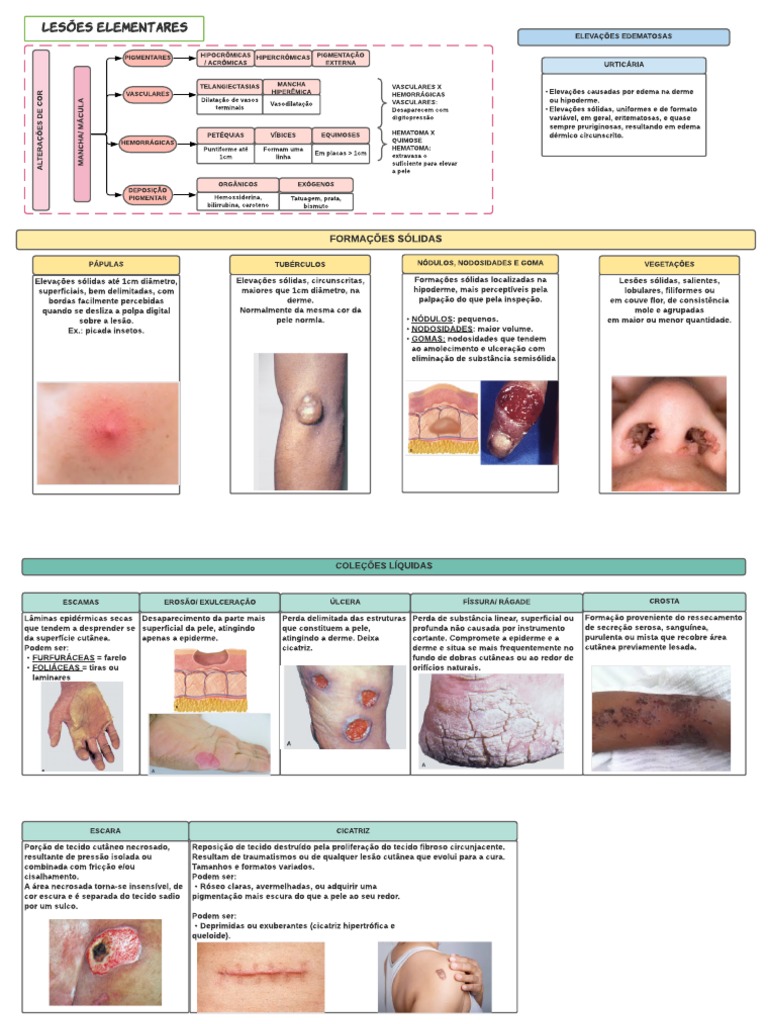 Mapa Mental Lesões Elementares | PDF | Pele | Especialidades médicas