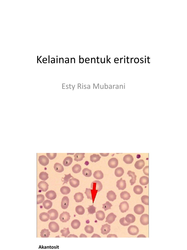 Kelainan Bentuk Eritrosit Pdf