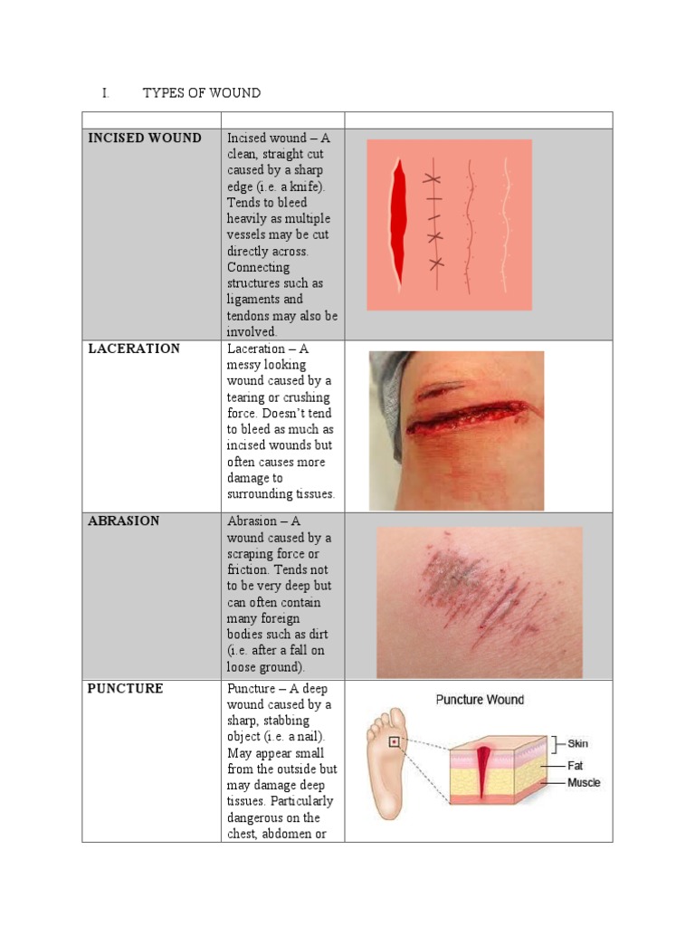 Avulsion Wound Definition
