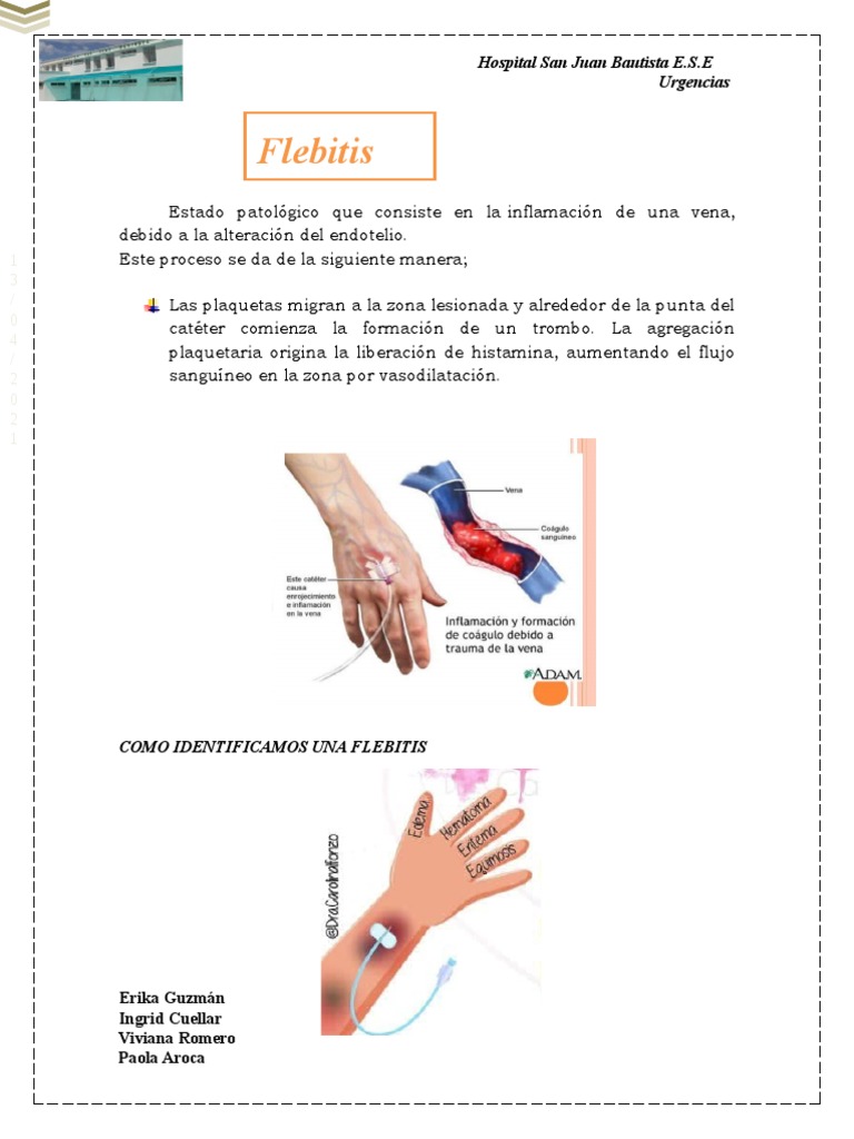 FLebitis Mecanica. | PDF | Terapia intravenosa | Plaqueta