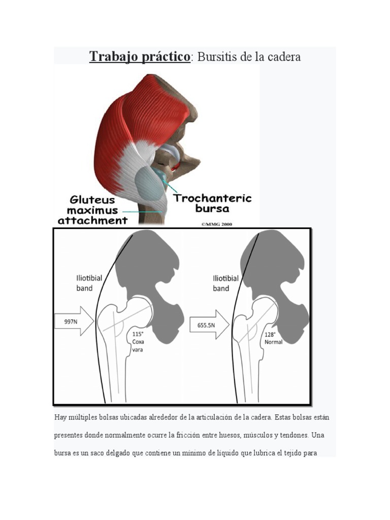Trabajo de Bursitis de La Cadera | PDF | Droga anti-inflamatoria libre ...