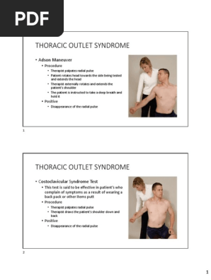 Wright Test Shoulder Thoracic Outlet Syndrome Physical Therapy: What