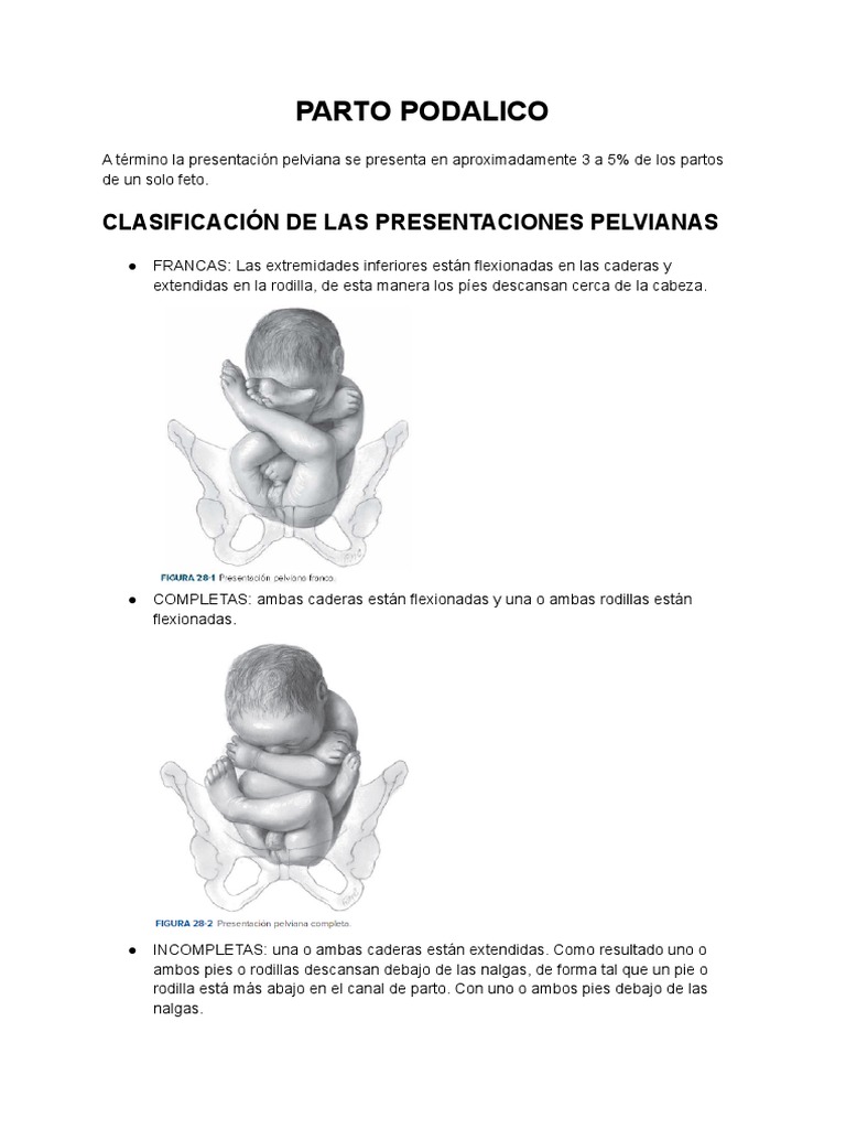 Parto Podálico: Tipos y Manejo | PDF | Parto | Pelvis