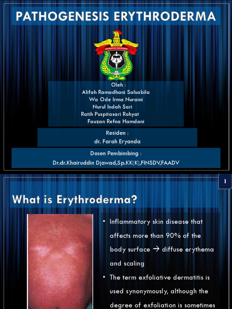 Understanding Erythroderma Pathogenesis | PDF | Dermatitis | Psoriasis
