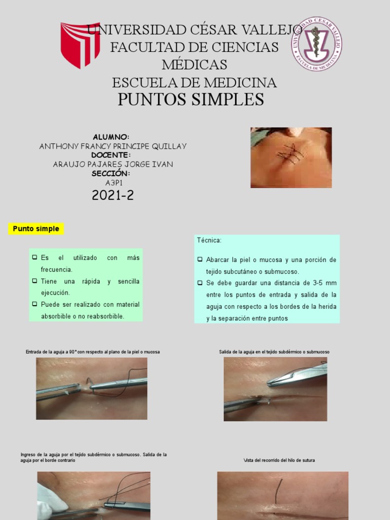 Punto Simples | PDF
