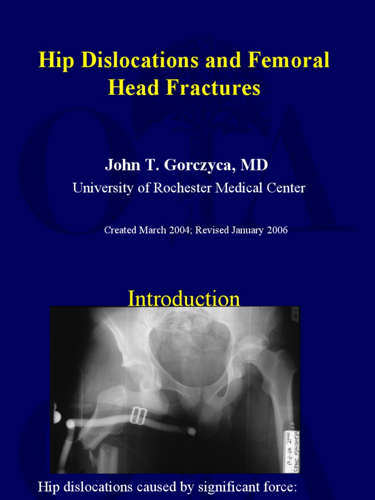 Hip Dislocations and Femoral Head Fractures: John T. Gorczyca, MD | PDF ...