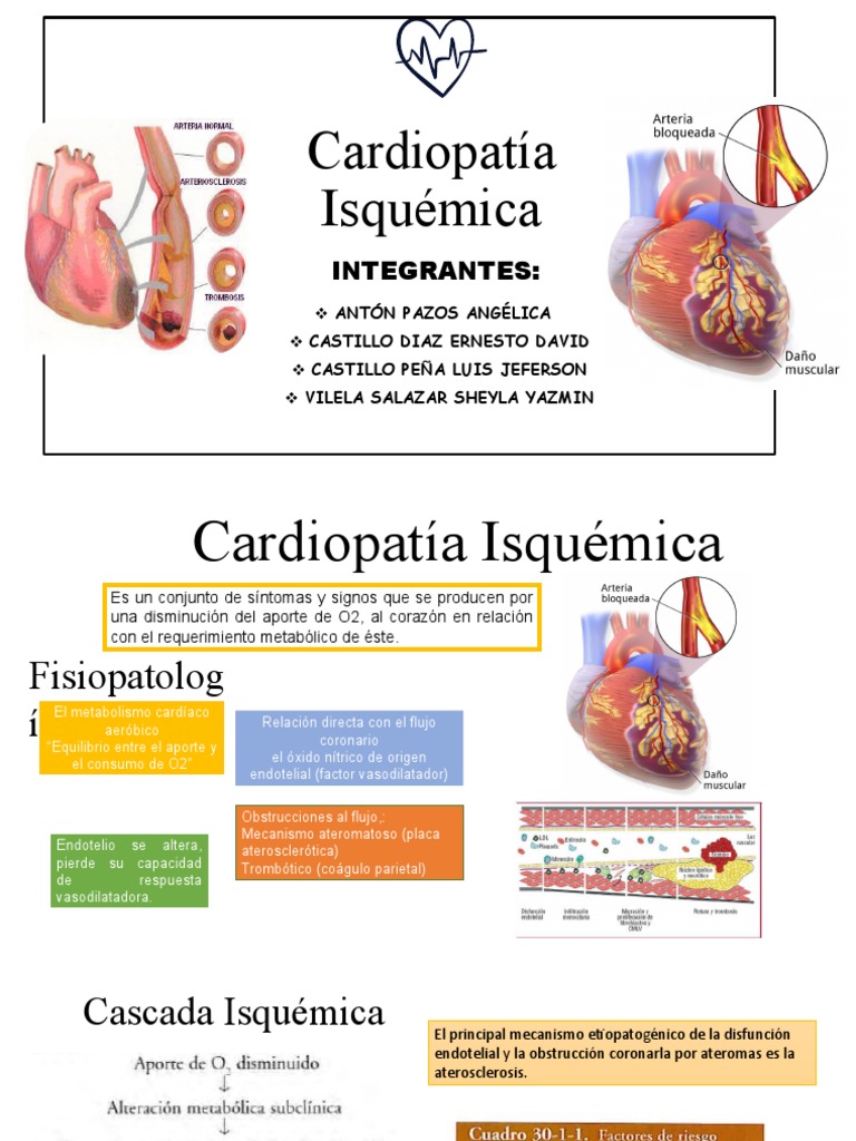 Cardiopatia Isquemica | PDF | Isquemia | Infarto de miocardio