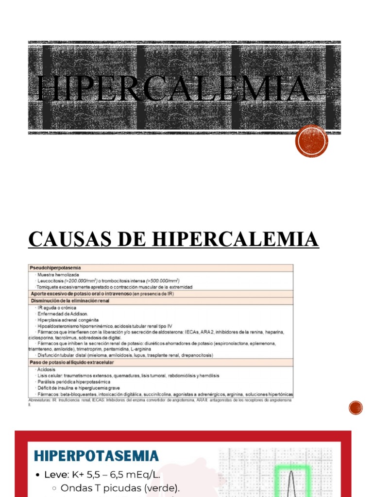 Hipercalemia | PDF