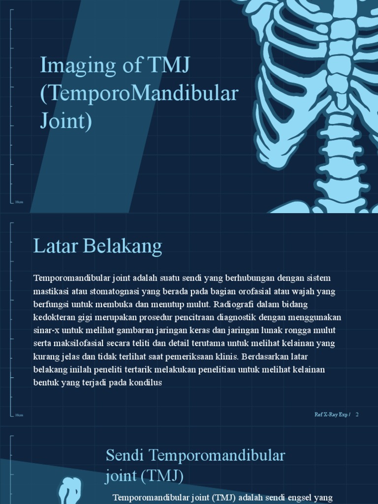 Imaging of TMJ (Temporomandibular Joint) | PDF