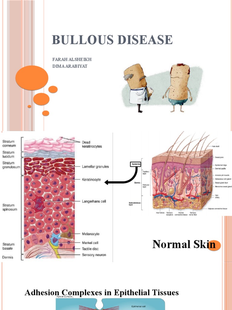 Bullous Disease: Farah Alsheikh Dima Arabiyat | PDF | Diseases And ...