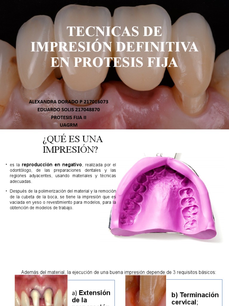 Tecnicas de Impresión Final en Protesis Fija | PDF | Dentadura postiza ...
