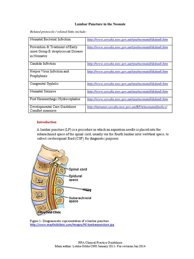 Related Protocols / Related Links Include:: Lumbar Puncture in The ...