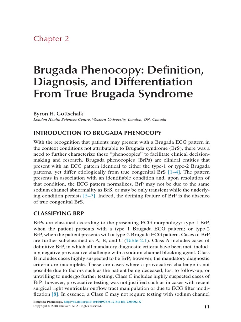 Brugada Phenocopy Definition, Diagnosis, and Differentiation From True ...