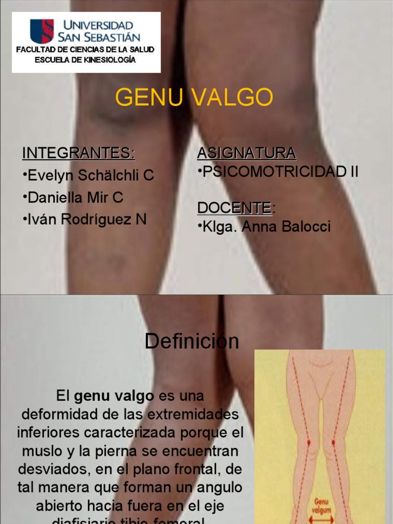 Tratamiento y Clasificación del Genu Valgo | PDF | Rodilla | Sistema ...