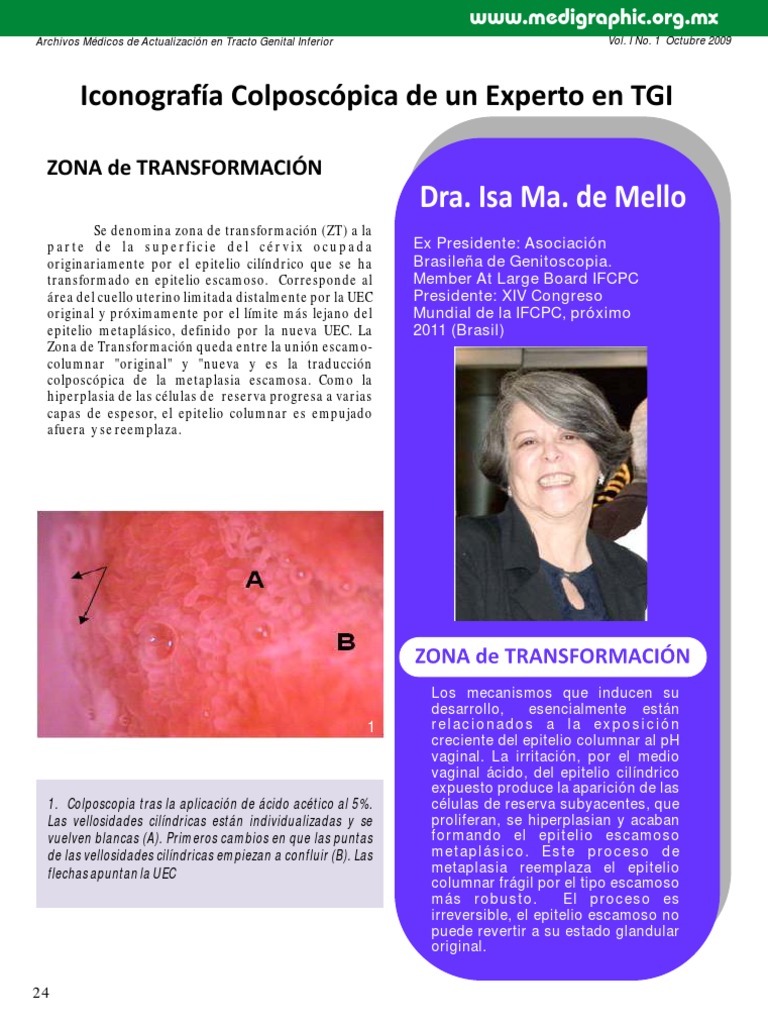 ZONA DE TRANFORMACION EN COLPOSCOPIA - Dra. Isa Ma. de Mello | PDF ...