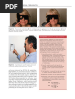 Confrontation Visual Fields - A Guide For Ophthalmologists in Training ...