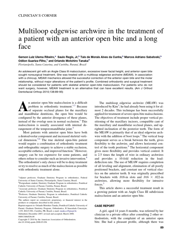 Multiloop Edgewise Archwire in The Treatment of A Patient With An ...