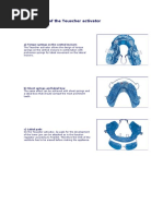Palato-Labial Tooth Movement Z Spring: Uses | PDF | Dentistry ...
