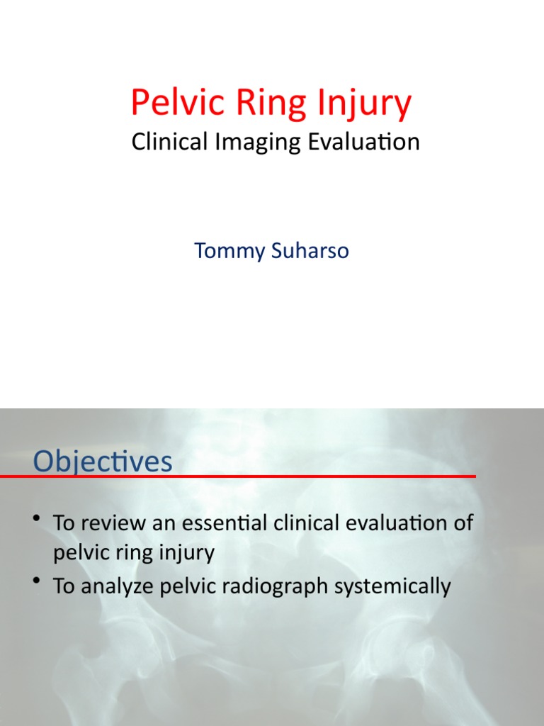 Pelvic Ring Injury Tommy | PDF | Pelvis | Musculoskeletal System