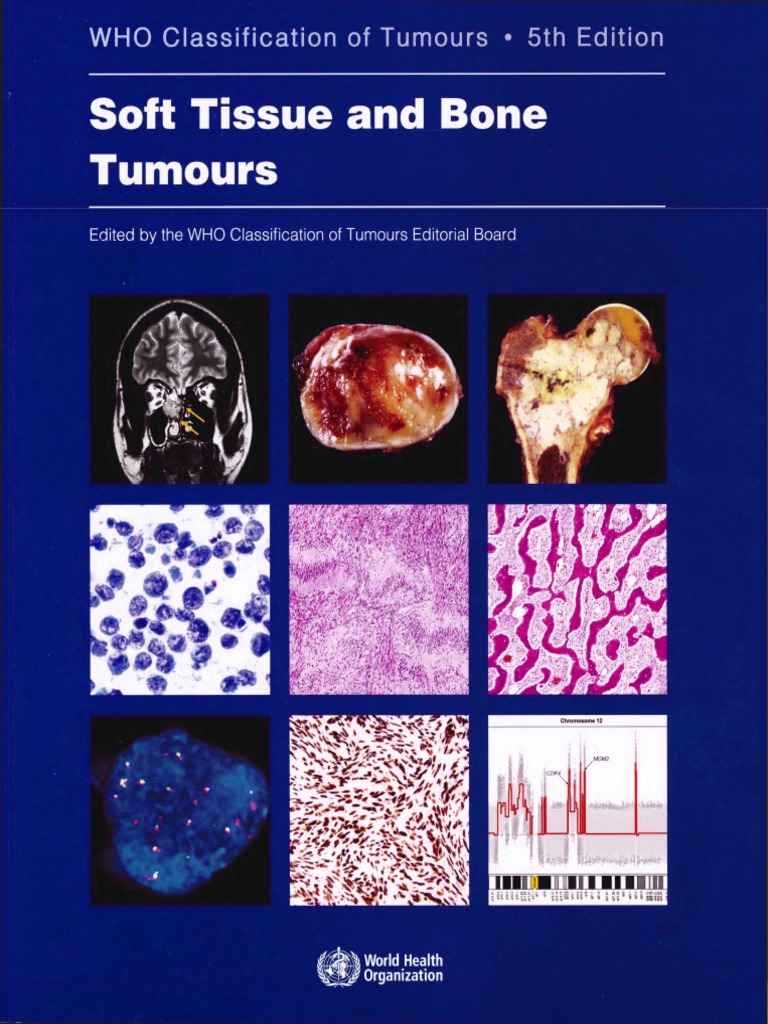 Soft Tissue and Bone Tum Ours: WHO Classification of Tumours - 5th ...