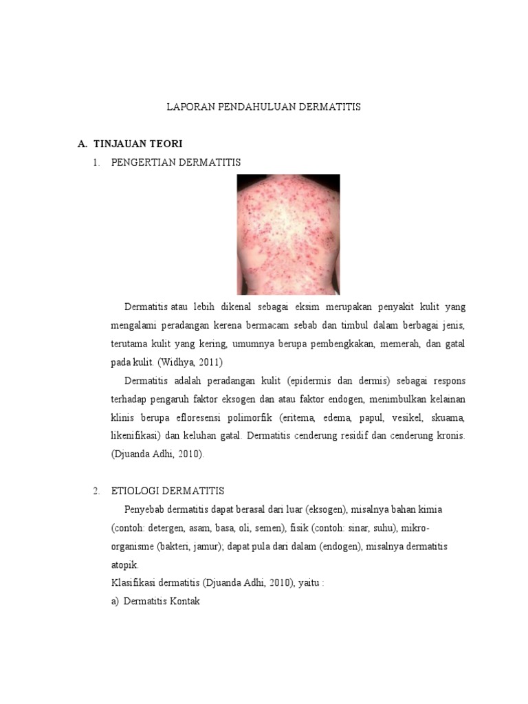 Dermatitis Pengertian Etiologi Patofisiologi Manifestasi Klinis Dan