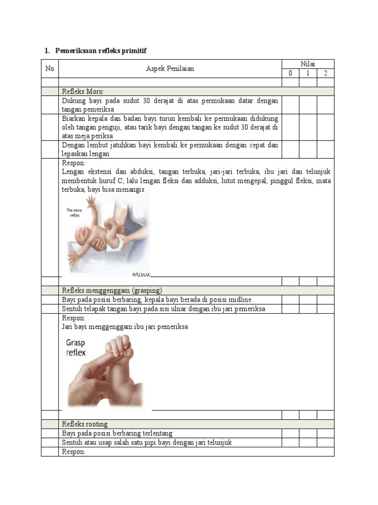 Pemeriksaan Refleks Primitif Pada Bayi | PDF