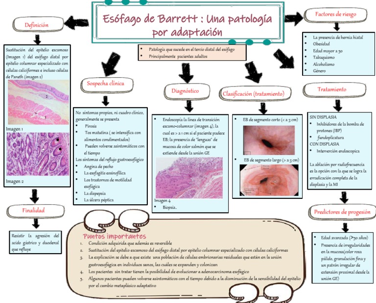 Esofago de Barrett | PDF | Enfermedades y trastornos | Epidemiología