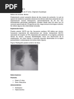 En Qué Consiste El MAPA y AMPA | PDF | Hipertensión | Presión sanguínea