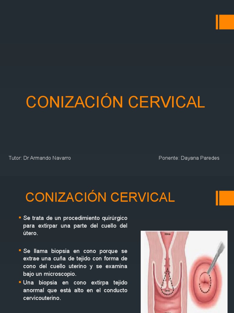Conización Cervical | PDF | Cáncer de cuello uterino | Especialidades Medicas