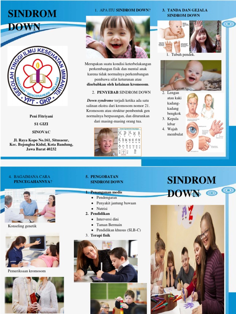 Sindrom Down | PDF