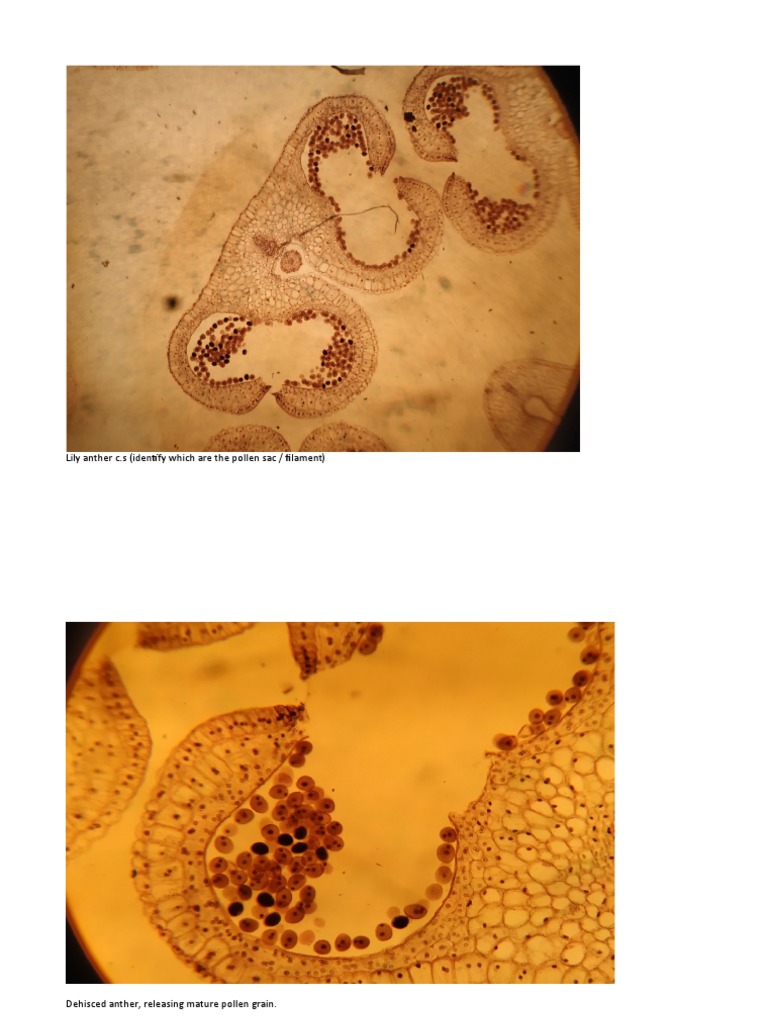 Part 2. Lily Anther and Ovary (Prepared Slides) | PDF