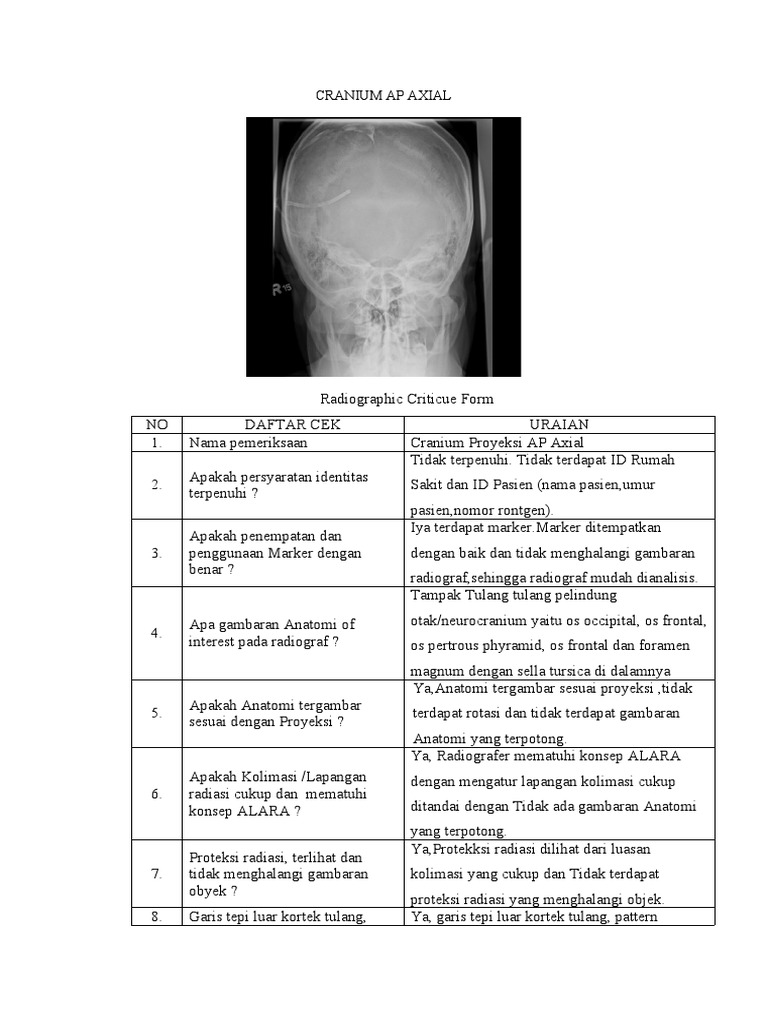 Cranium Ap Axial | PDF
