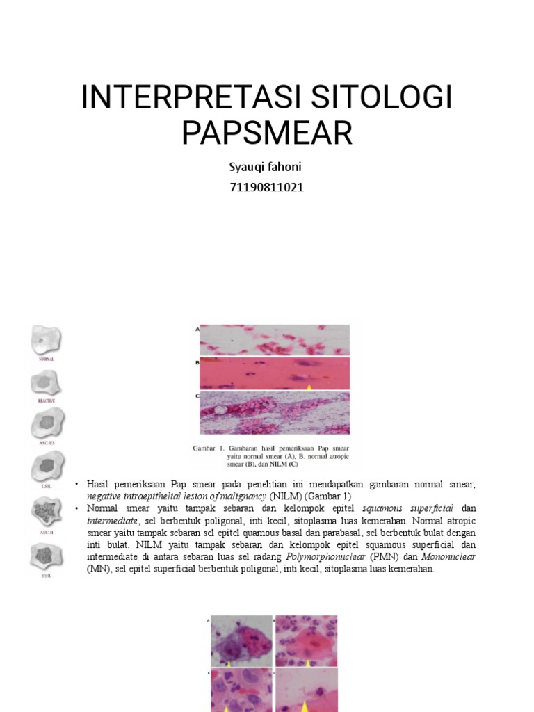 Interpretasi Hasil Pap Smear Normal | PDF
