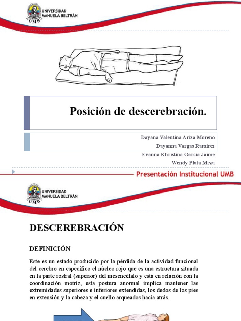 Posición de Descerebración | PDF | Lesión cerebral traumática ...