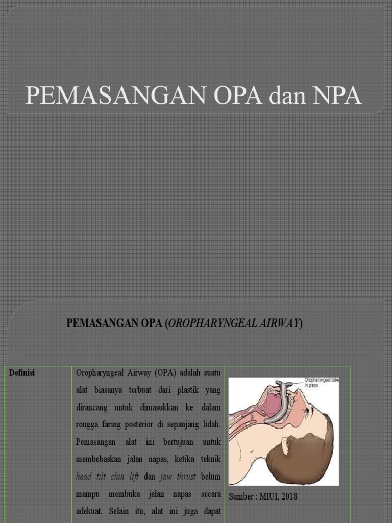 Pemasangan Opa Dan Npa | PDF