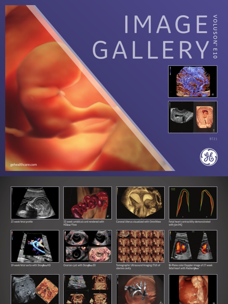 2020 Voluson E10 bt21 Image Gallery jb83610xxt 5 | PDF