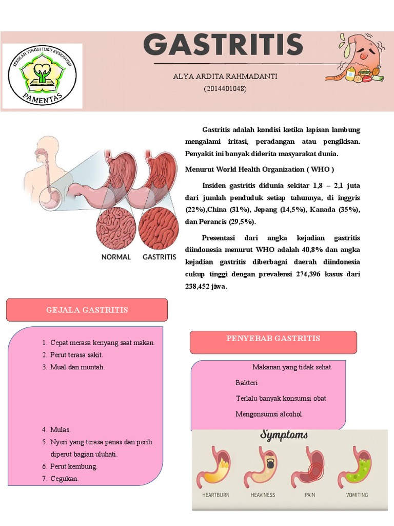 Poster Gastritis | PDF