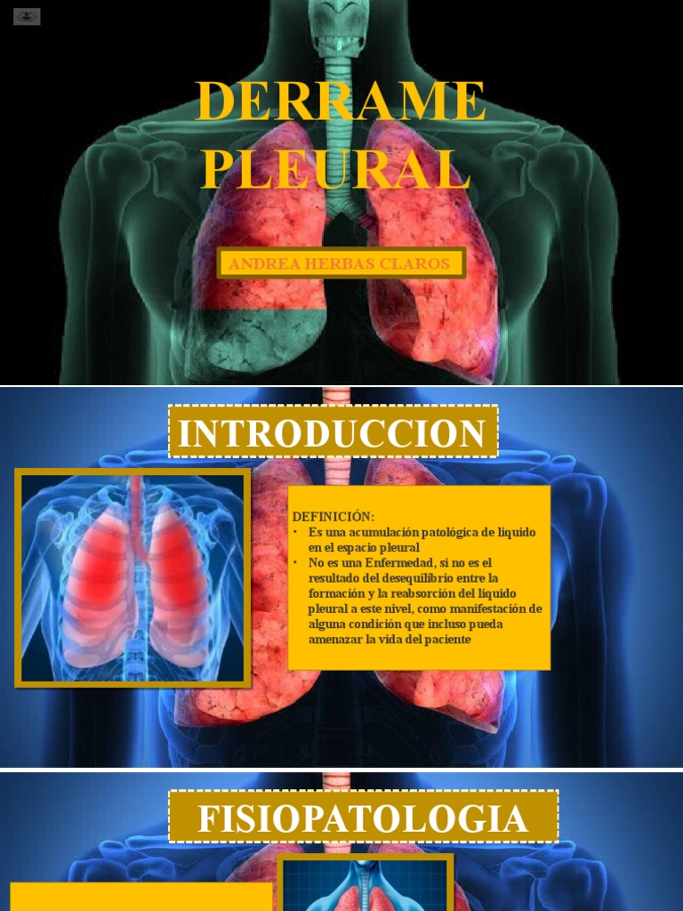 Derrame Pleural: Causas y Diagnóstico | PDF | Medicina | Epidemiología