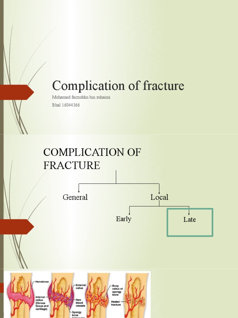 Complication of Fracture | PDF | Bone | Surgical Specialties