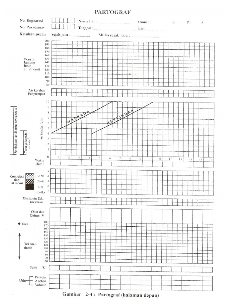 Patograf Persalinan Normal | PDF
