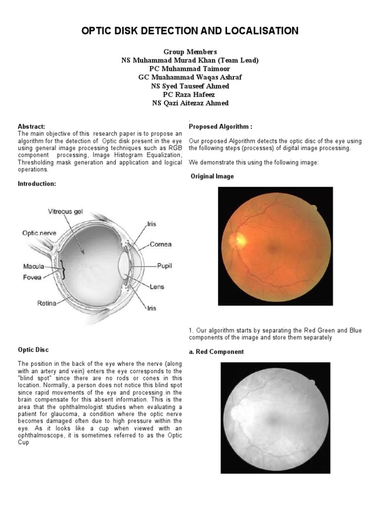 Optic Disk Detection and Ion | PDF | Optics | Eye
