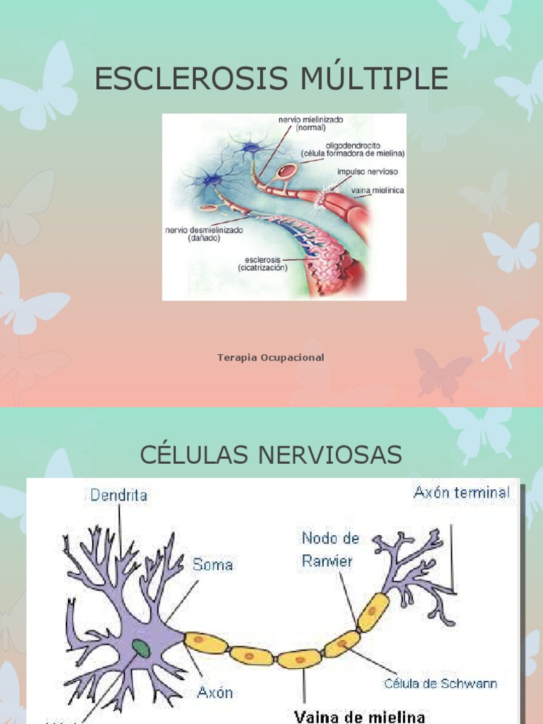 Esclerosis Multiple | PDF | Esclerosis múltiple | Nervio